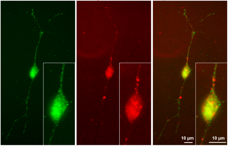 Institute of Functional Genomics (IGF) - Montpellier - CNRS